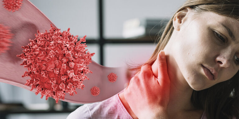 Can Allergies Cause Swollen Lymph Nodes? Key Facts Explained