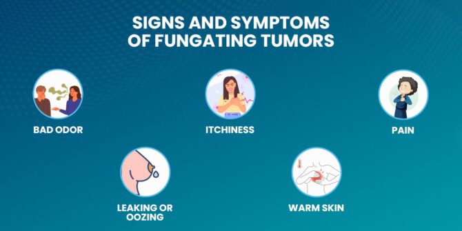 Fungating Breast Cancer: When Cancer Resembles Fungal Growth