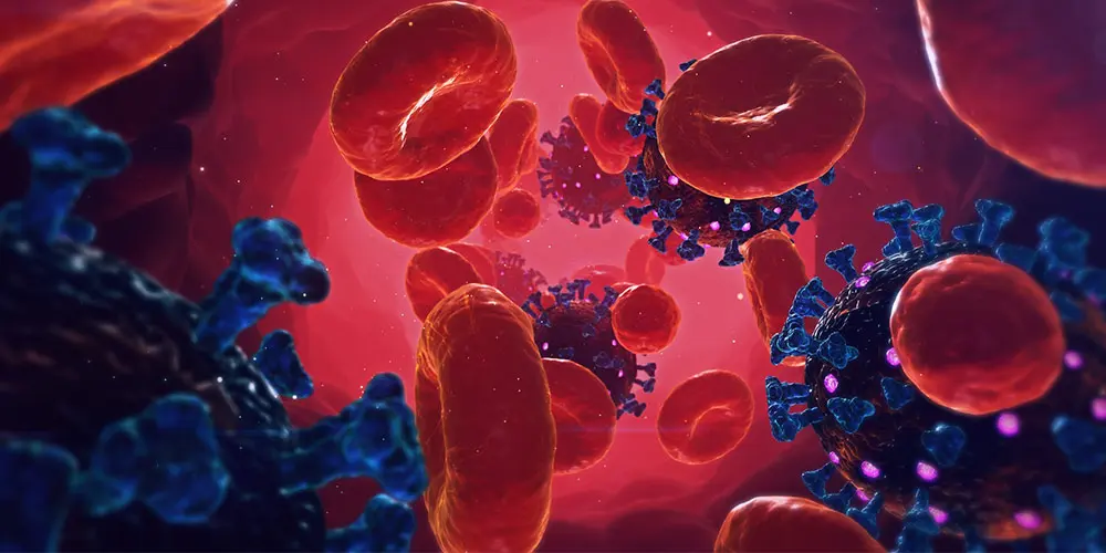 Richter's Syndrome in CLL: Transformation Explained